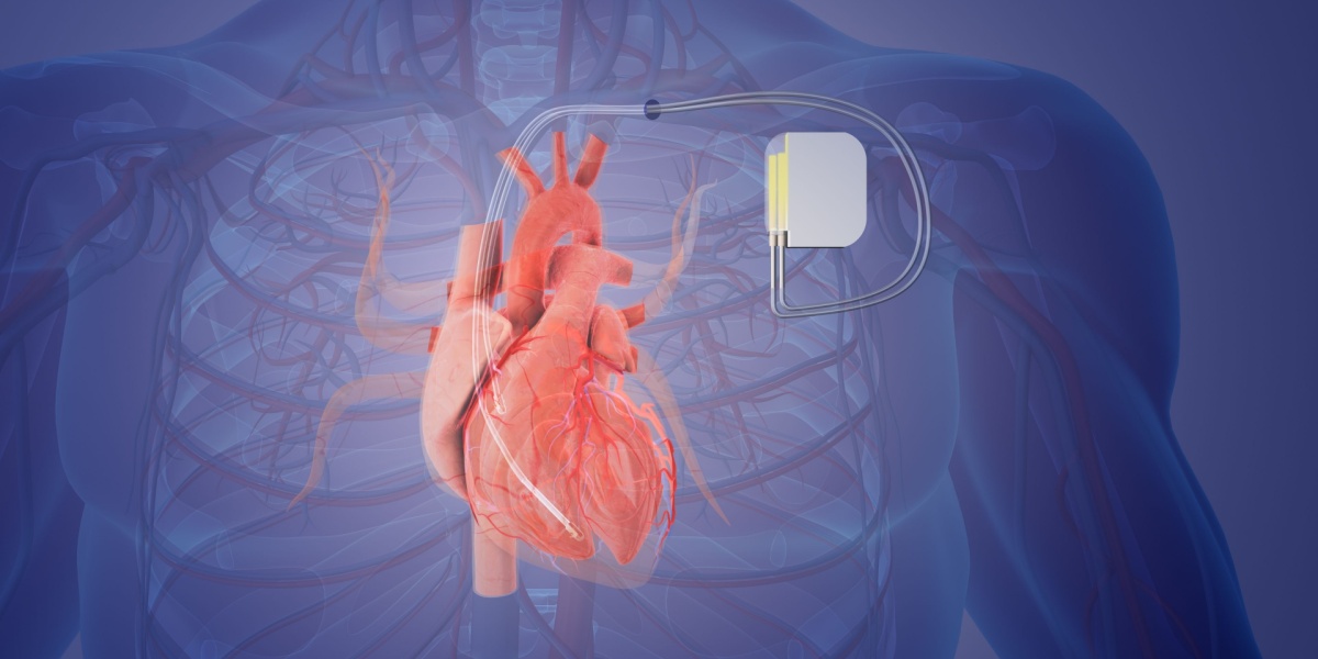 Advances in Pacemaker Technology: A New Battery-Free Design